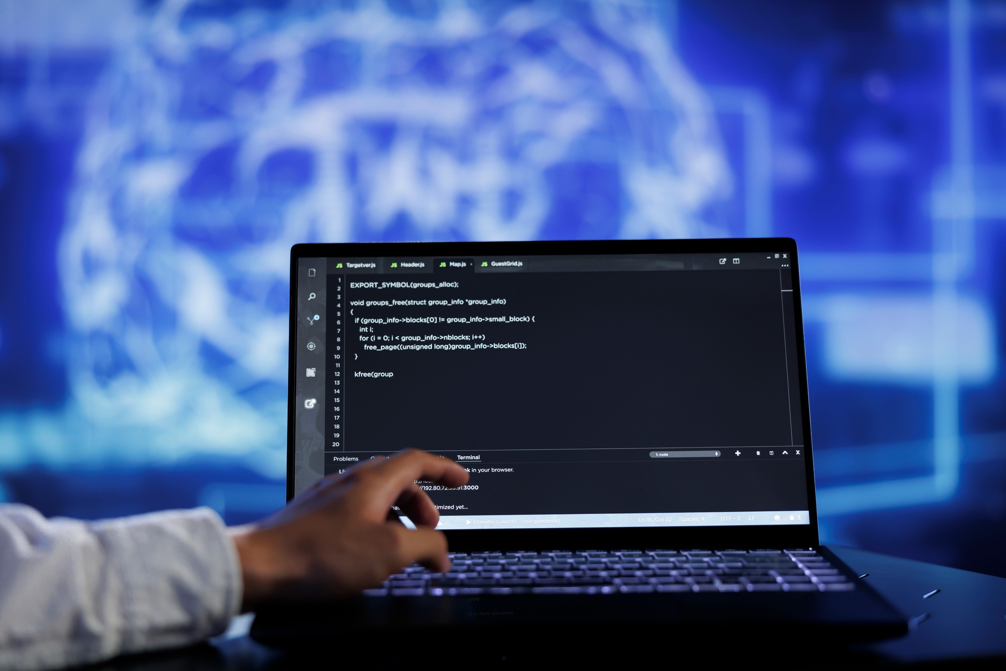 Expert writes AI code on laptop – Acuity, Inc.